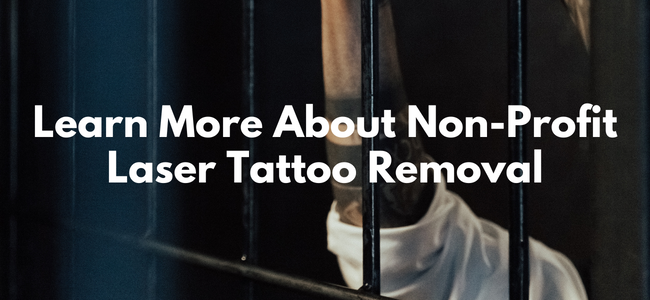 Astanza Clients Changing Lives with Non-profit Laser Tattoo Removal ...